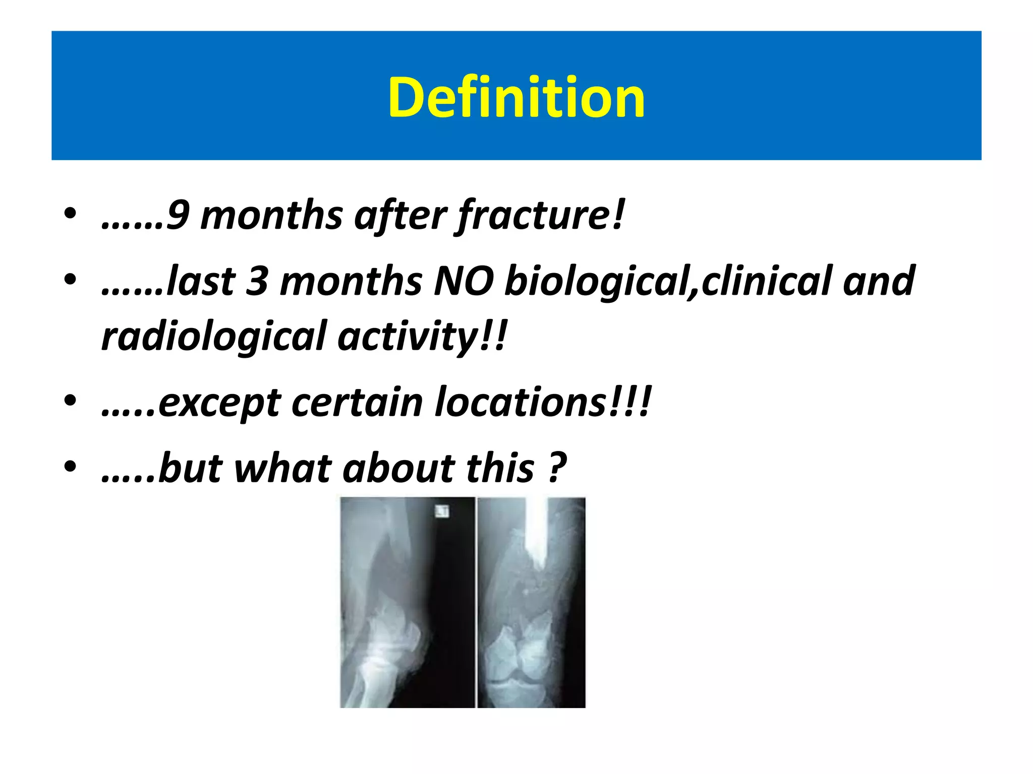 Non union of fractures dr mohamed ashraf,HOD orthopaedics,govt TD ...