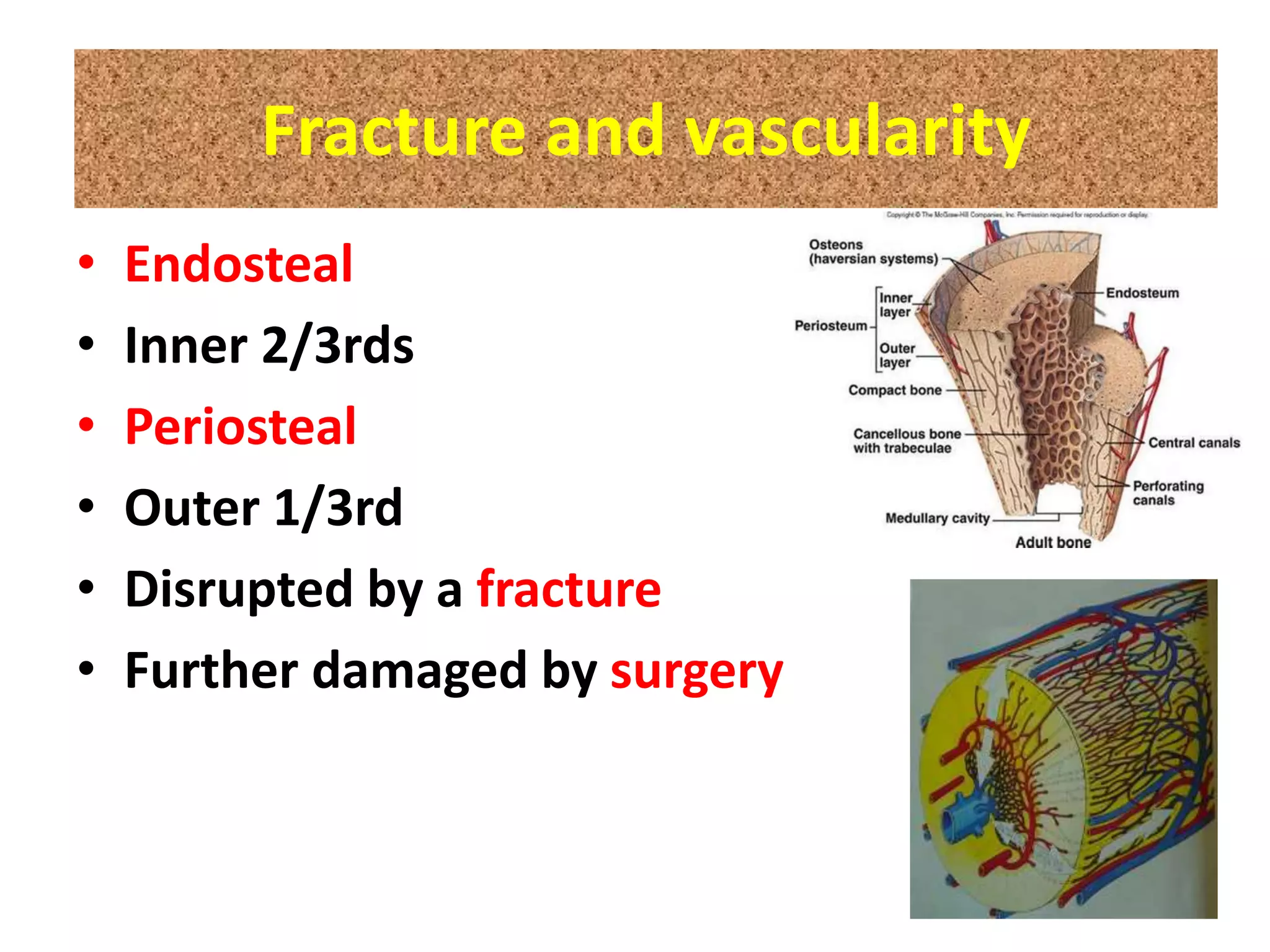 Non union of fractures dr mohamed ashraf,HOD orthopaedics,govt TD ...