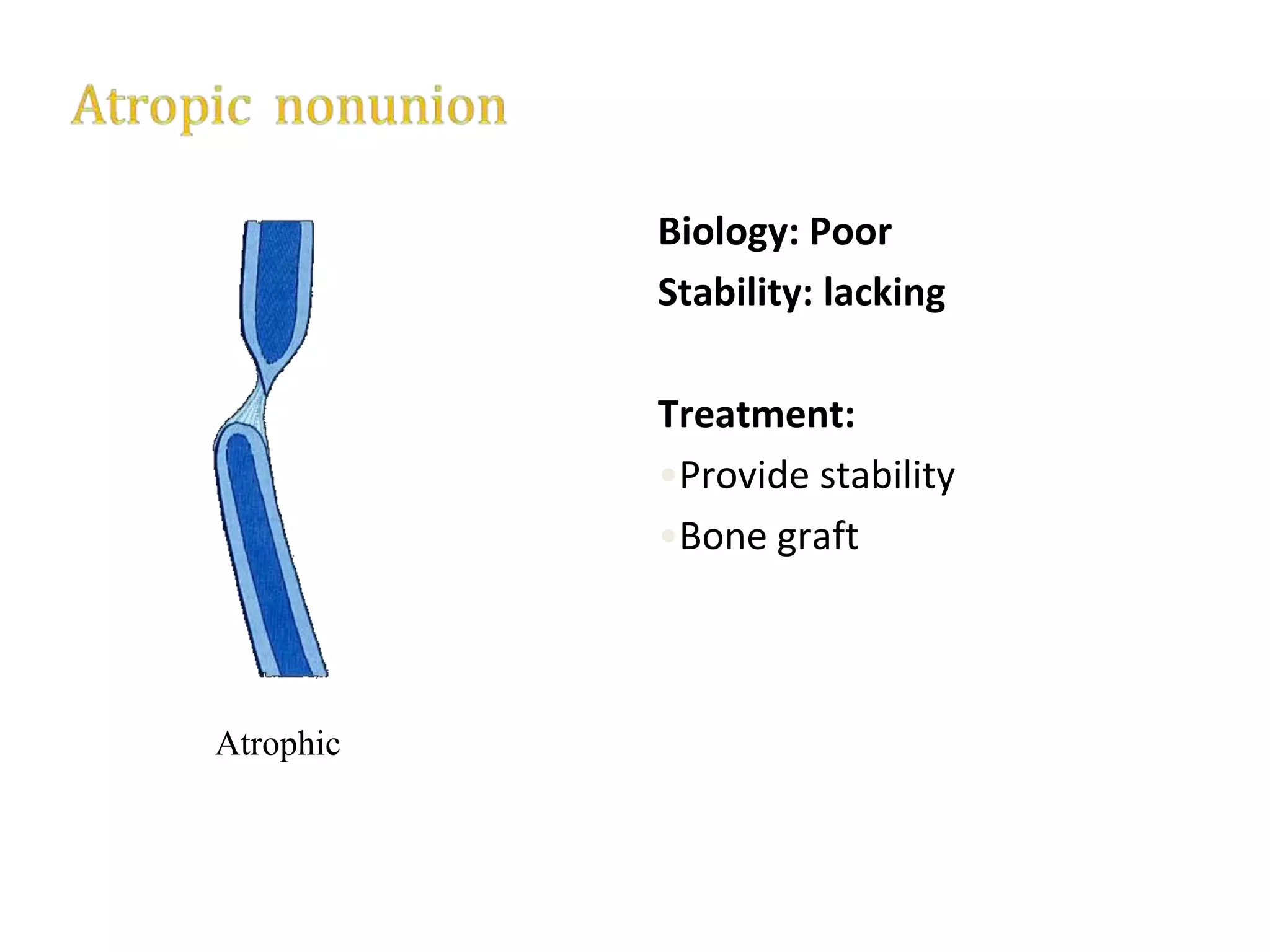Nonunion definition, causes, classification and management | PPTX