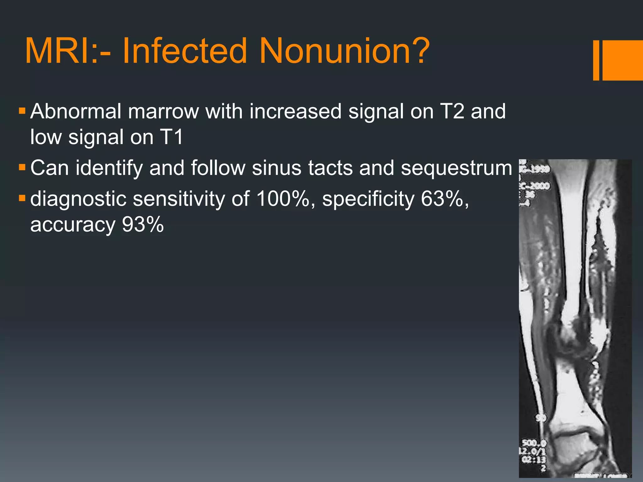 Nonunion ppt | PPTX