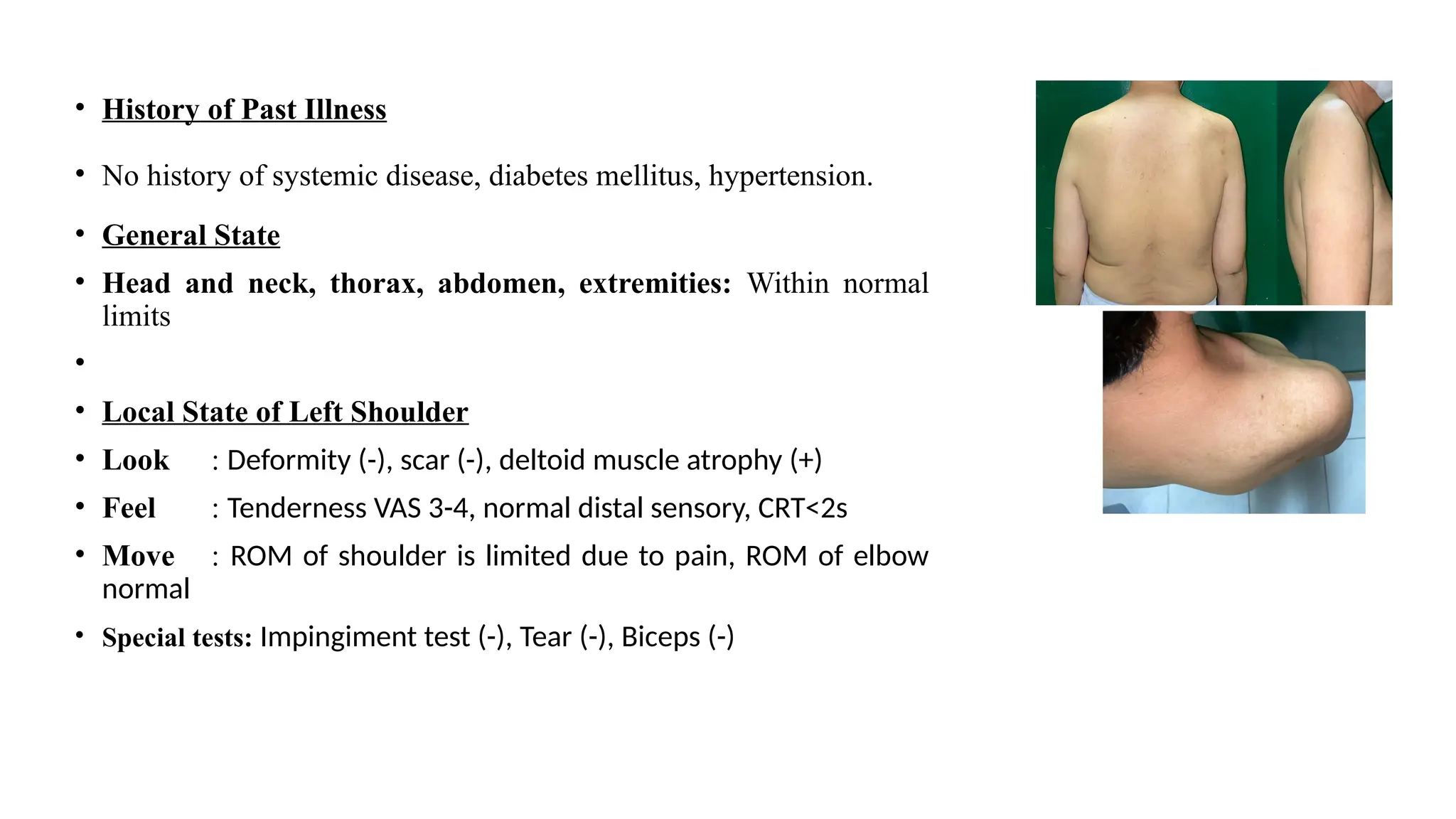 Case Report Non Union Proximal Humerus.pptx
