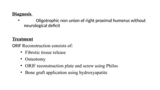 Case Report Non Union Proximal Humerus.pptx