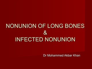 Nonunions of long bones akbar | PPT
