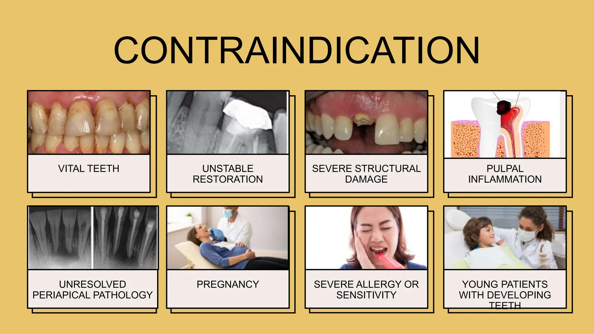 Non Vital Tooth Bleaching .pptx- conservative and endodontics | PPTX