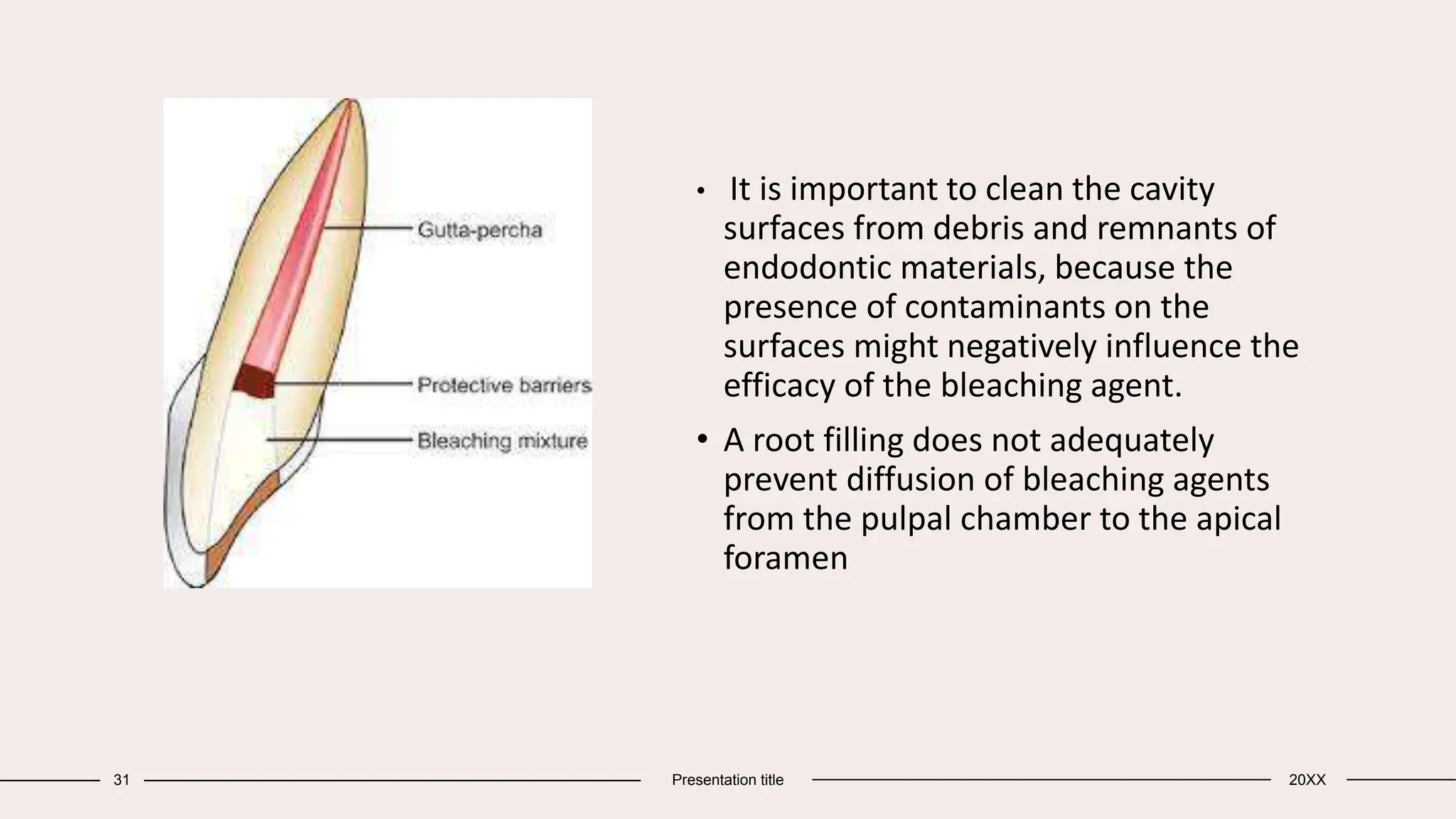 Non Vital Tooth Bleaching .pptx- conservative and endodontics | PPTX