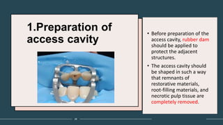 Non Vital Tooth Bleaching .pptx- conservative and endodontics | PPTX