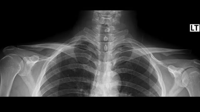 Noon | PPT | Free Download