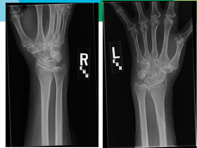 Noon conference 9 11 | PPT