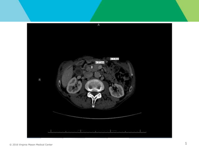 Noon conference bergman | PPT