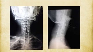 Noon conference hangman | PPT | Free Download