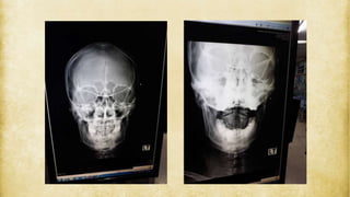 Noon conference hangman | PPT | Free Download