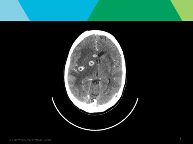 Noon conference ja 01-31-18 | PPTX