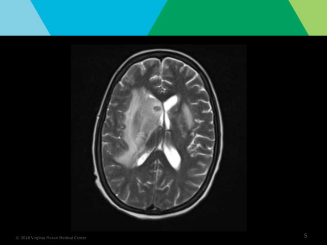 Noon conference ja 01-31-18 | PPTX