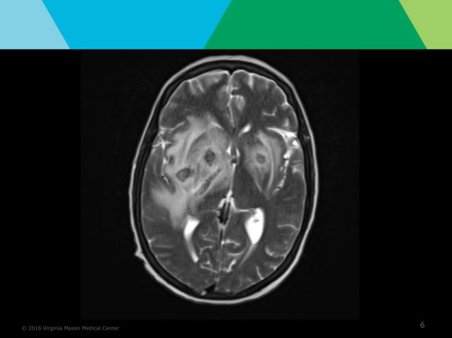 Noon conference ja 01-31-18 | PPTX