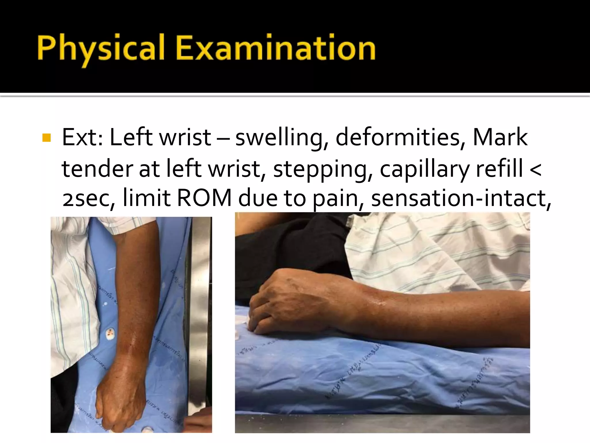 distal end radius fracture | PPTX