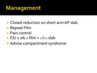 distal end radius fracture | PPTX