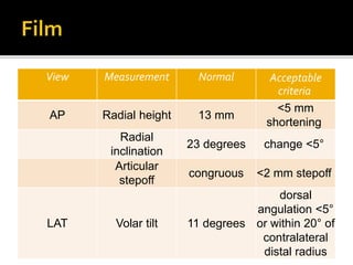 distal end radius fracture | PPTX