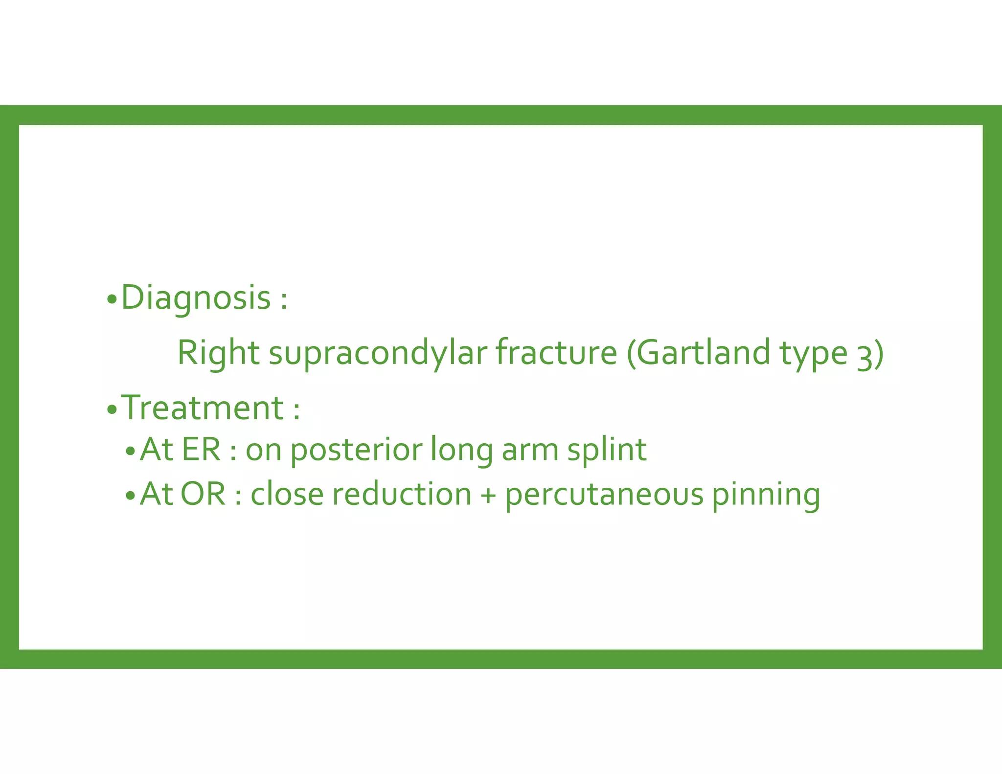 supracondyle fracture | PDF