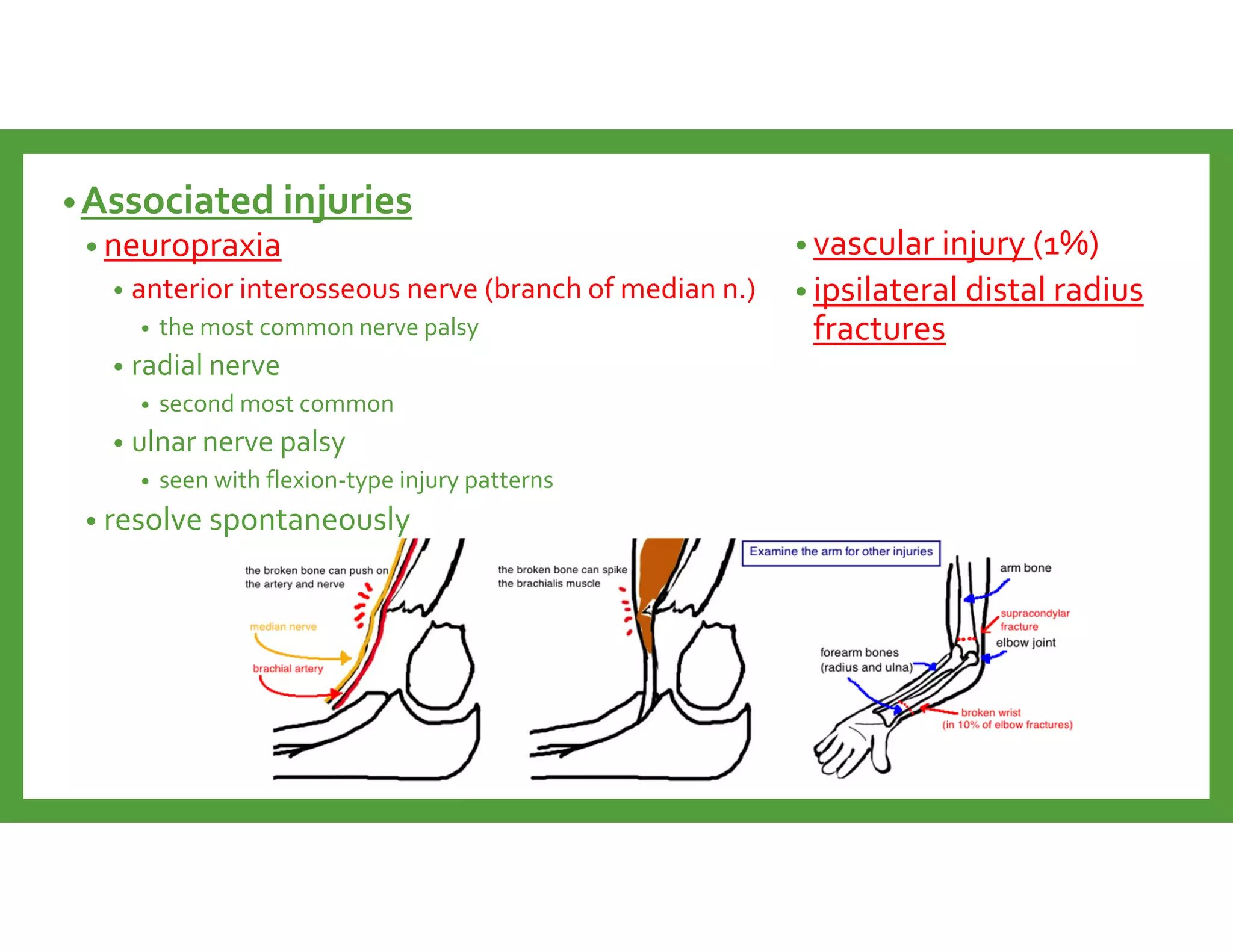 supracondyle fracture | PDF