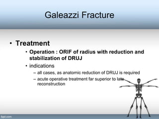 Noon ortho galeazzi ext.natchanan petchboon | PPTX