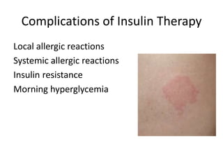 Glucose Monitoring | PPTX