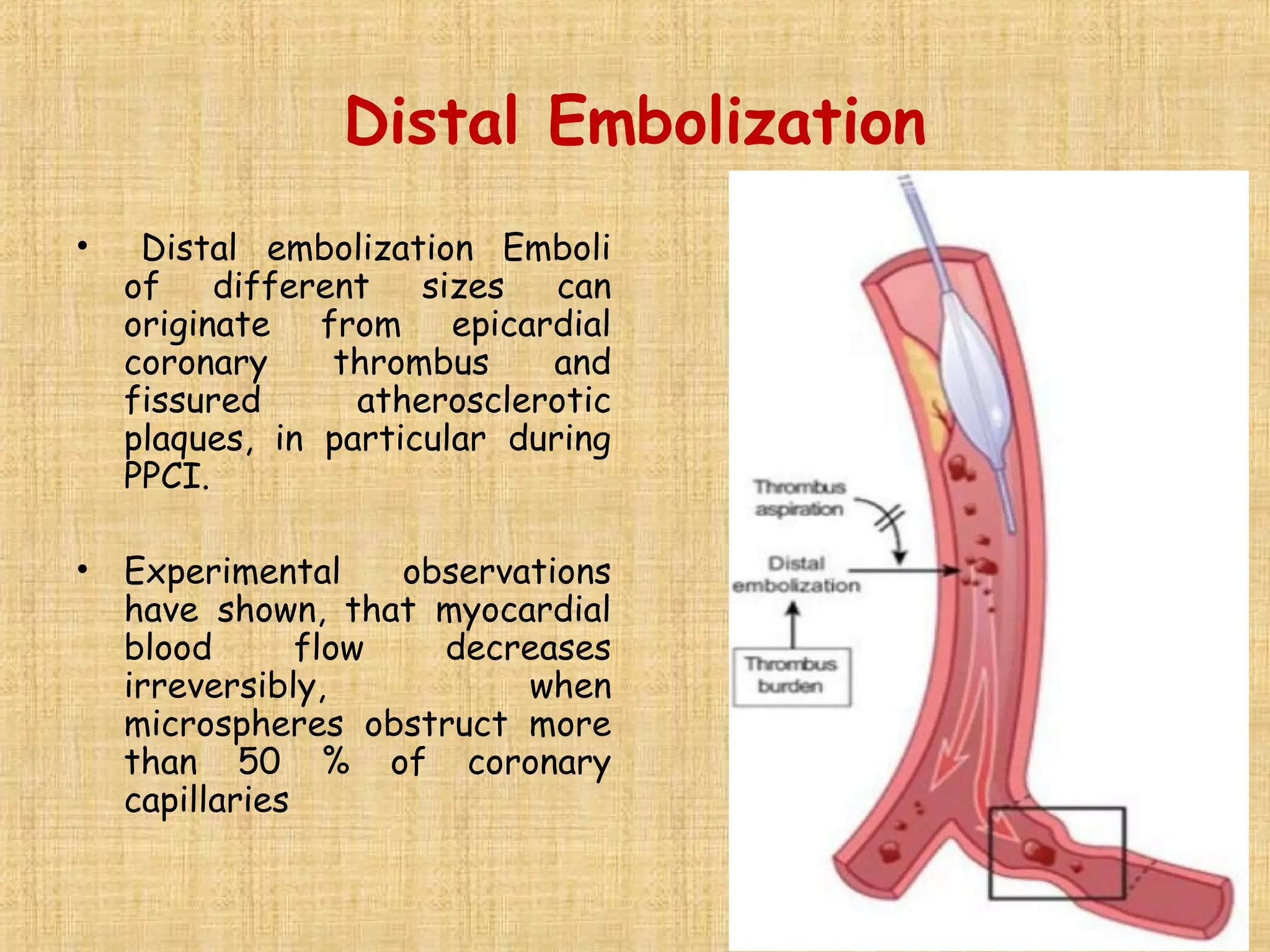 No reflow and slow flow phenomenon during pci | PPT
