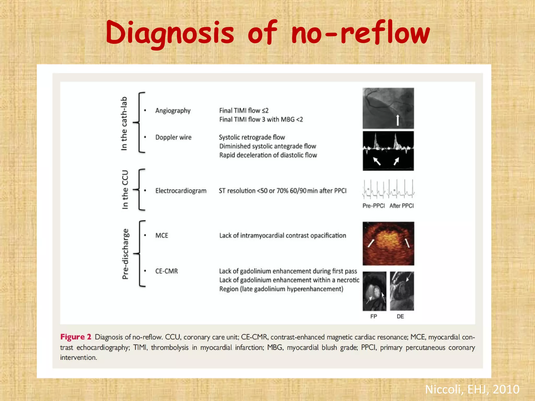 No reflow and slow flow phenomenon during pci | PPT