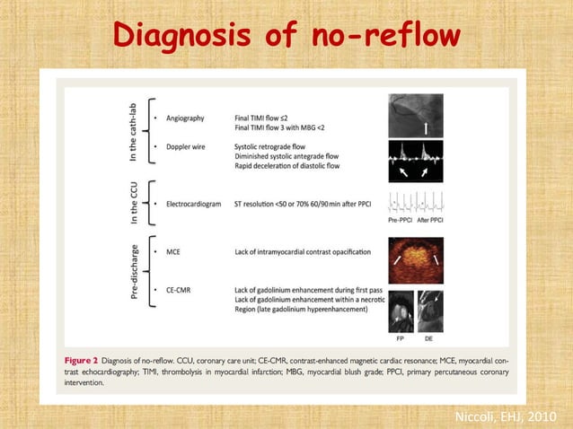 No reflow and slow flow phenomenon during pci | PPT | Heart and Cardiovascular Diseases ...