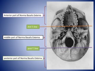 norma b extrnaالثالثه تشريح راس.pptx