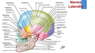 Norma Frontalis, Lateralis, Verticalis, Basalis (cranial base).pptx