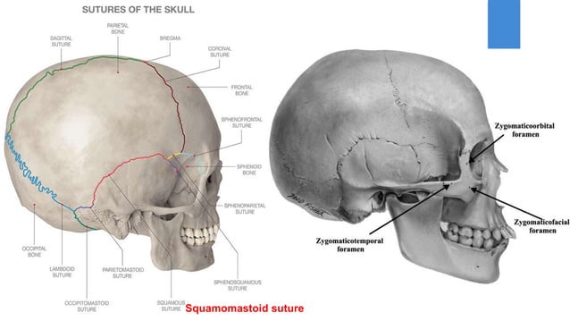 Norma Frontalis, Lateralis, Verticalis, Basalis (cranial base).pptx