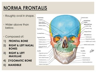 Norma_Frontalis_PDF.pdf gross anatomy of norma | PPT