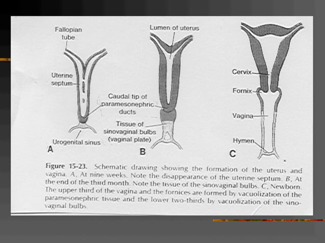 Normal and abnormal genital tract | PDF