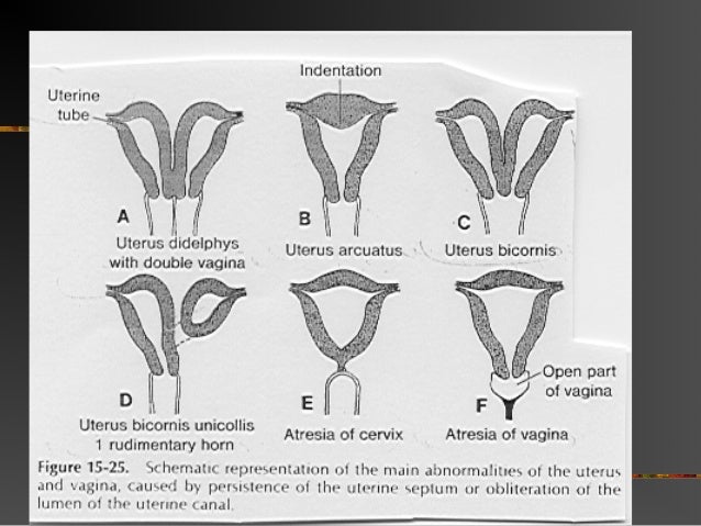 Normal And Abnormal Genital Tract