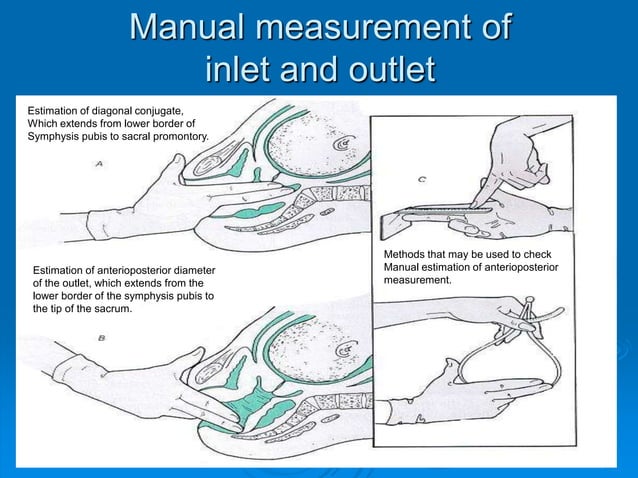 Normal-Obstetrics.ppt