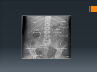 Normal abd xray rjj.pptx