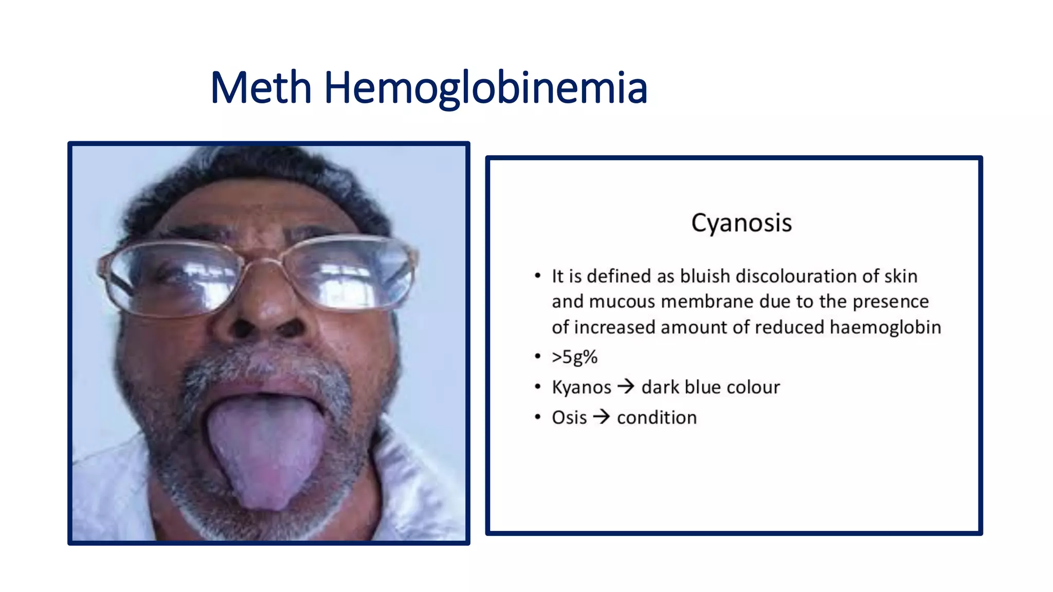 Normal & abnormal hemoglobin derivatives | PDF