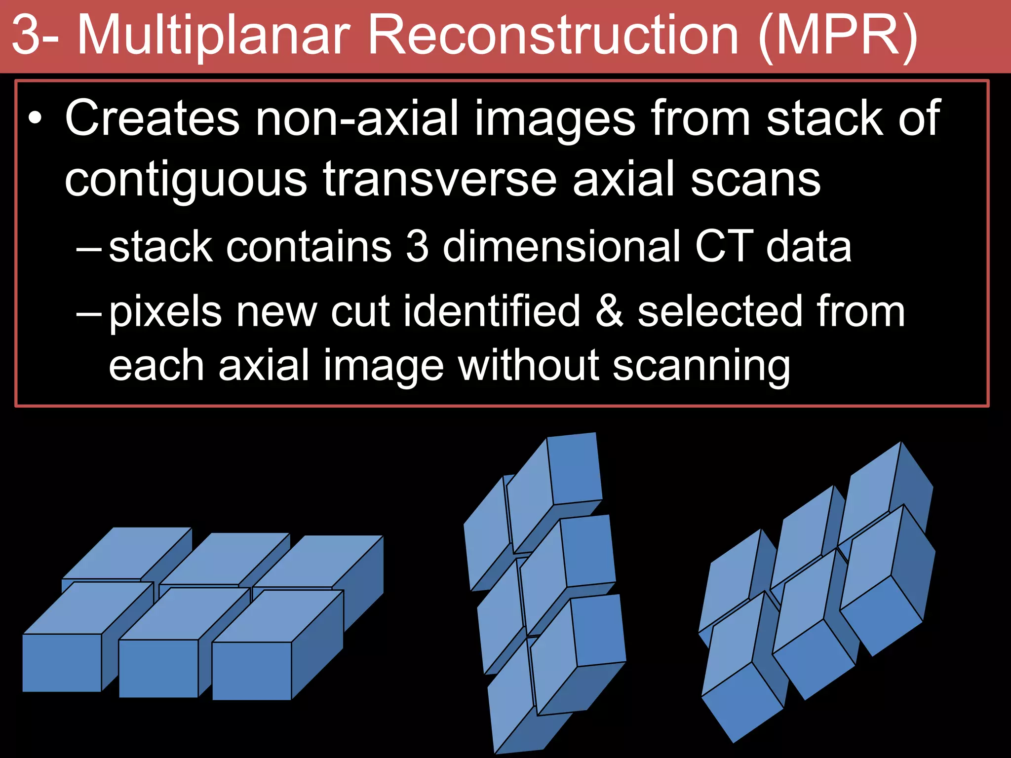 Normal & abnormal radiology of brain part ii | PPTX