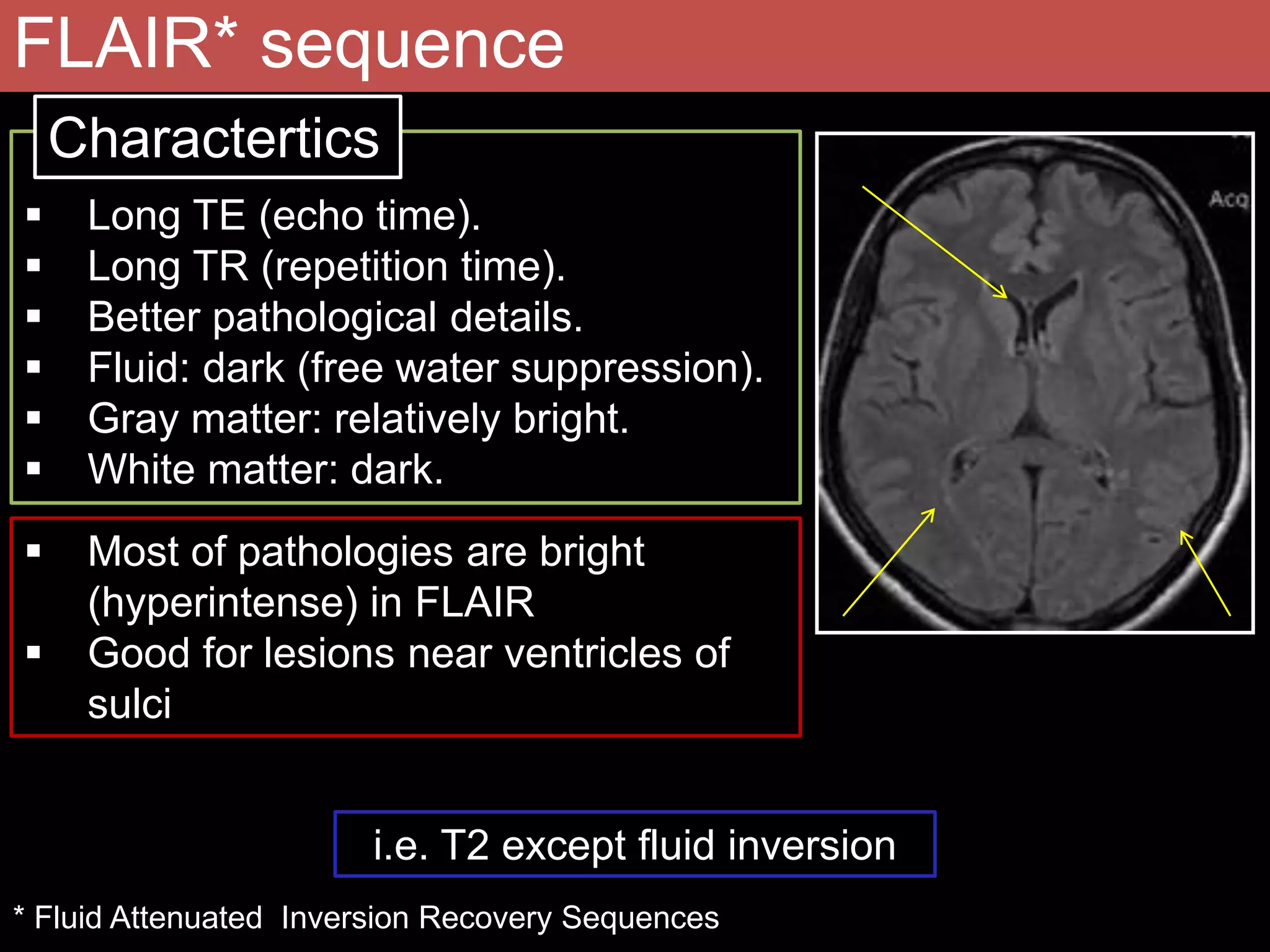 Normal & abnormal radiology of brain part ii | PPTX