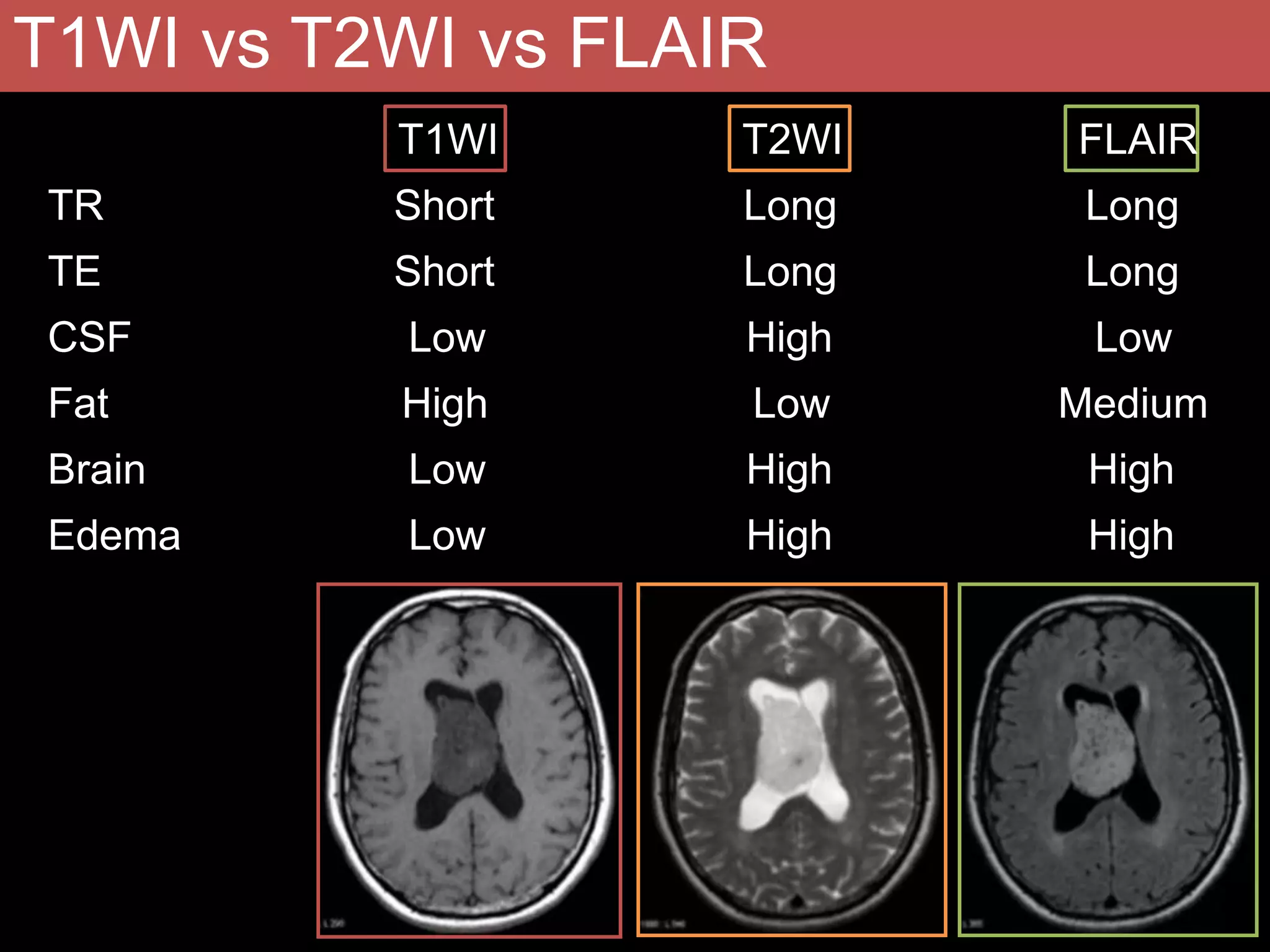 Normal & abnormal radiology of brain part ii | PPTX