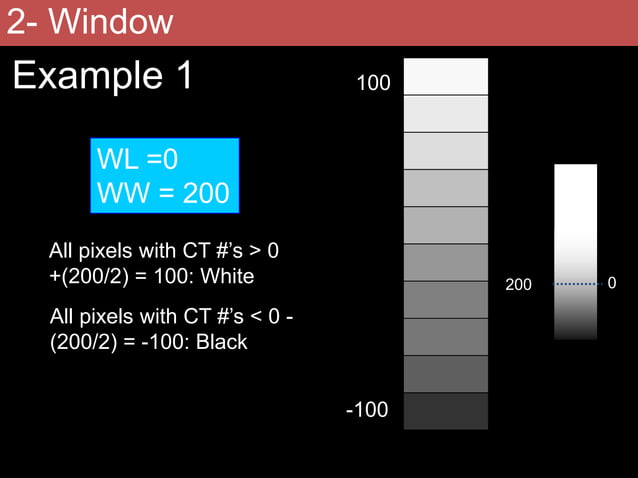 Normal & abnormal radiology of brain part ii | PPTX