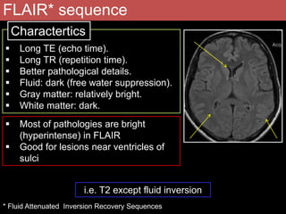Normal & abnormal radiology of brain part ii | PPTX