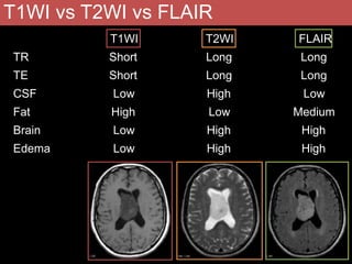 Normal & abnormal radiology of brain part ii | PPTX