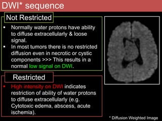 Normal & abnormal radiology of brain part ii | PPTX