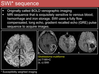 Normal & abnormal radiology of brain part ii | PPTX