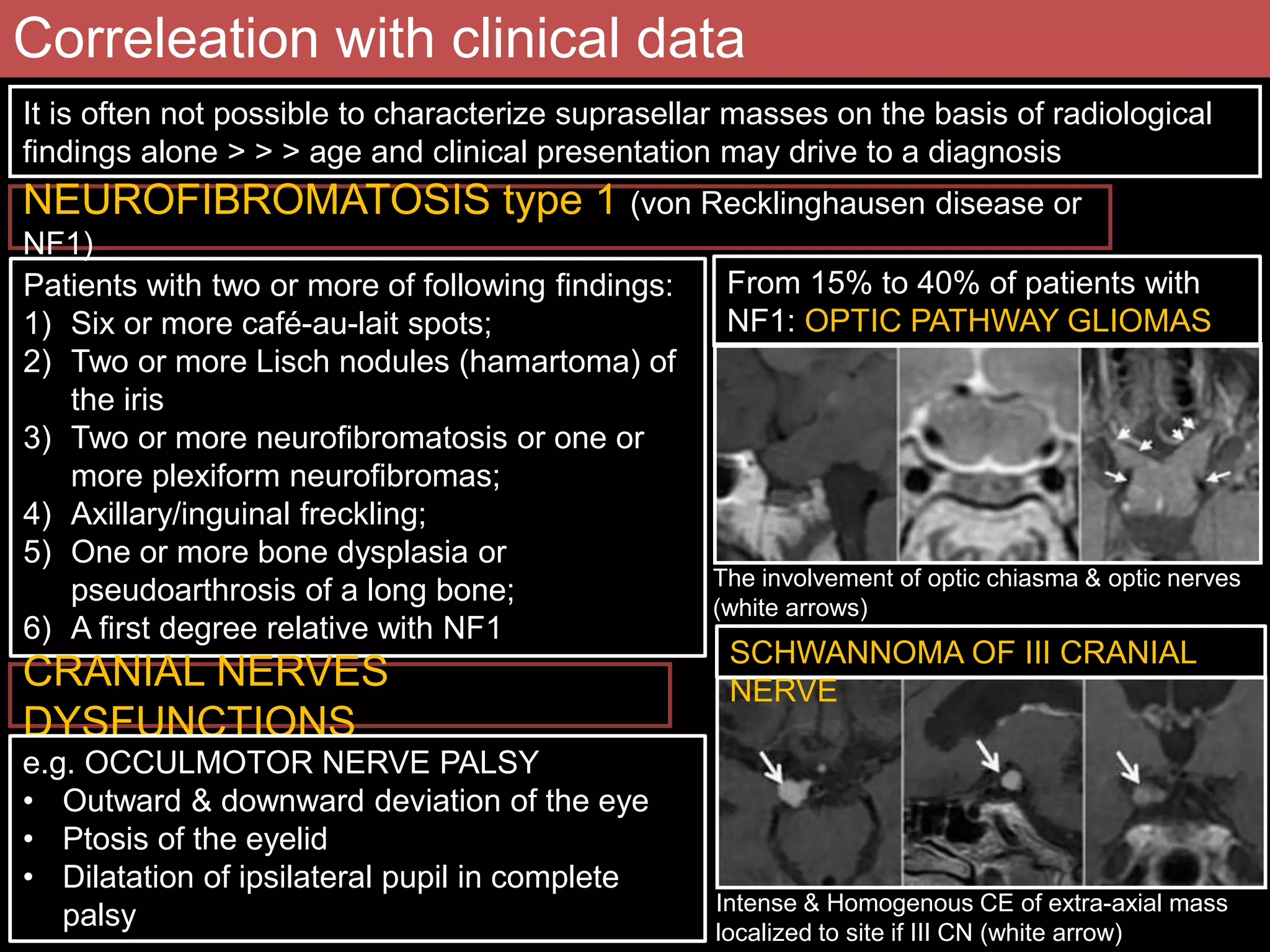 Normal & abnormal radiology of brain part iv | PPTX