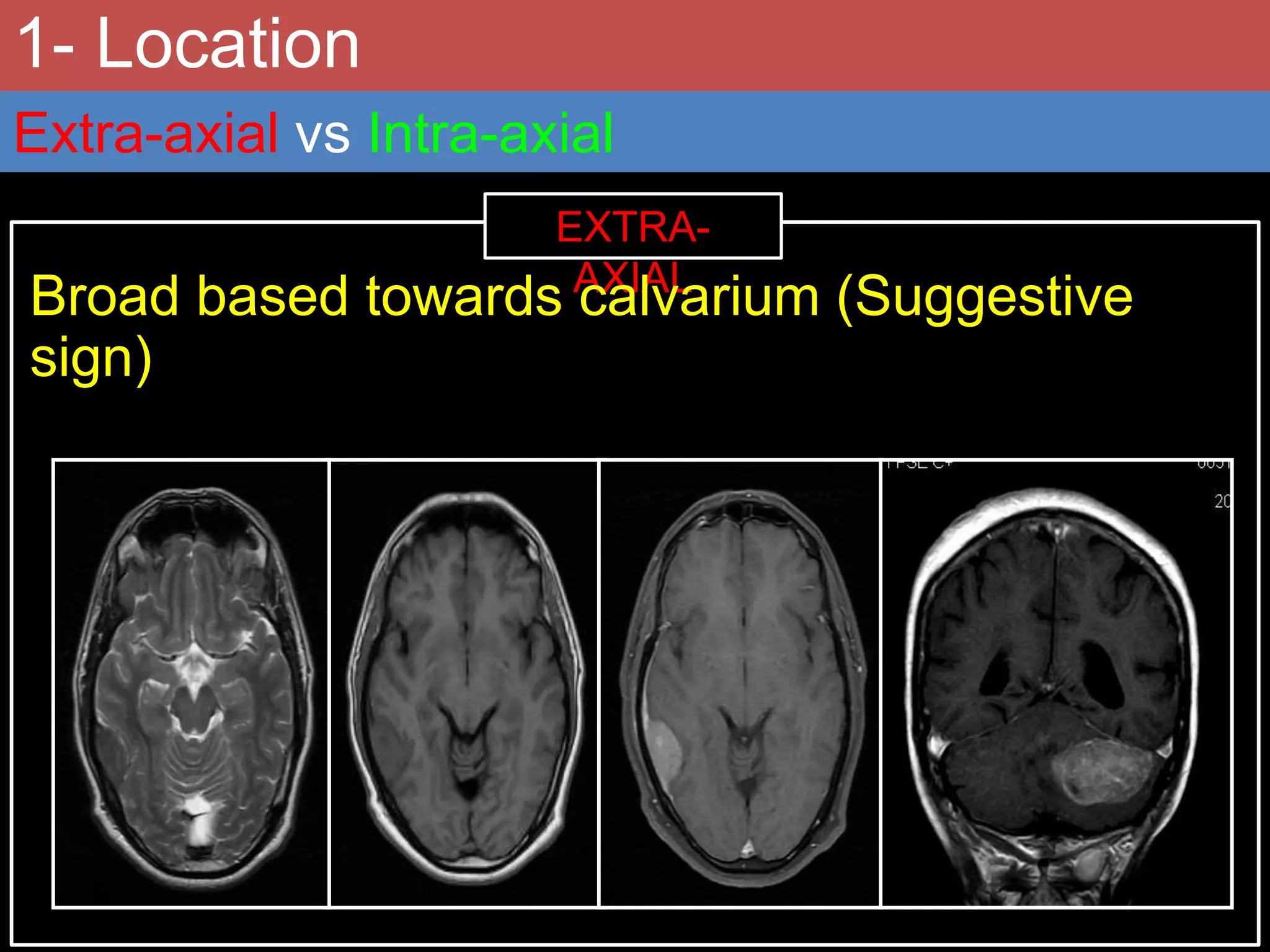 Normal & abnormal radiology of brain part iv | PPTX