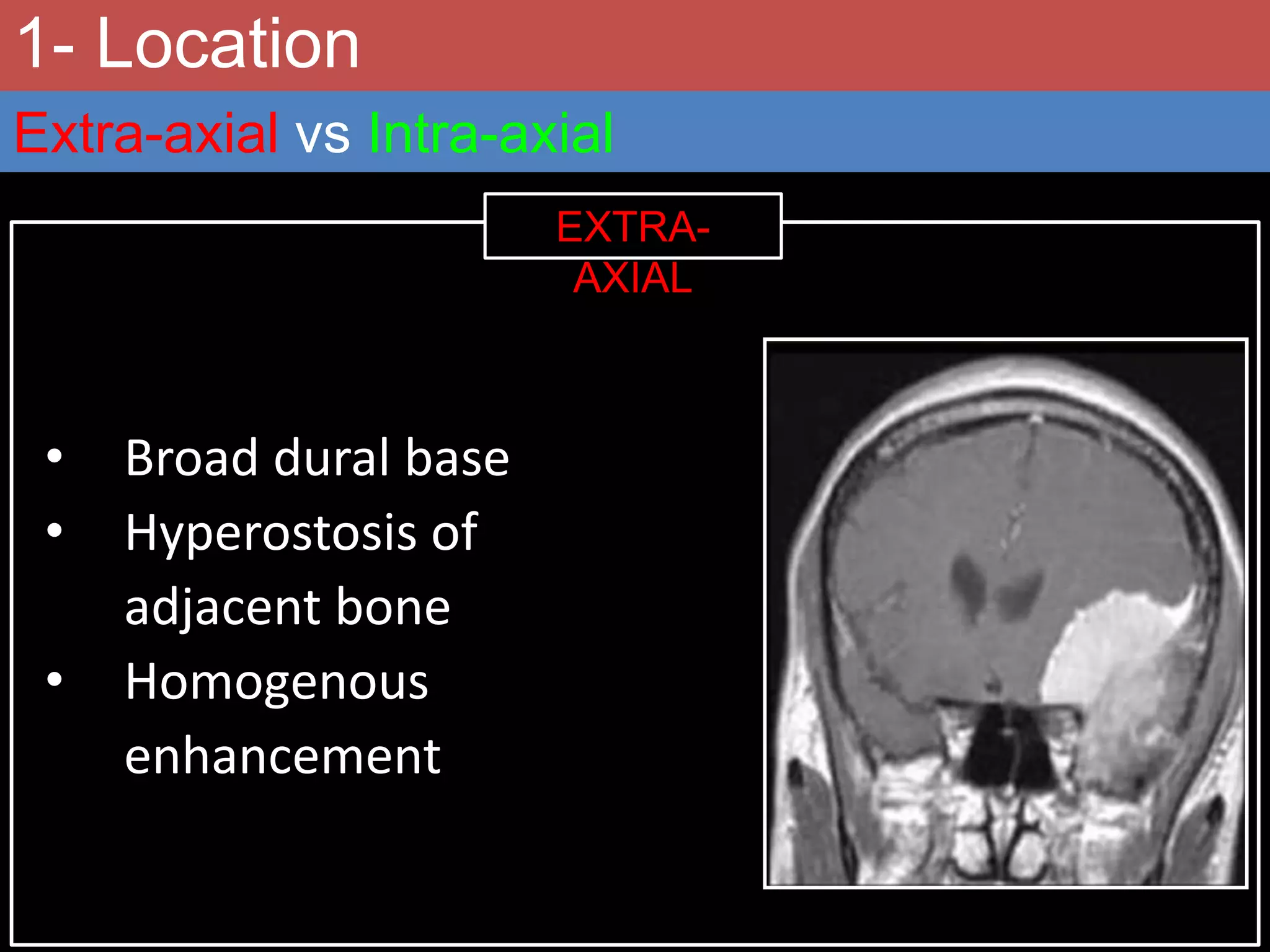 Normal & abnormal radiology of brain part iv | PPTX