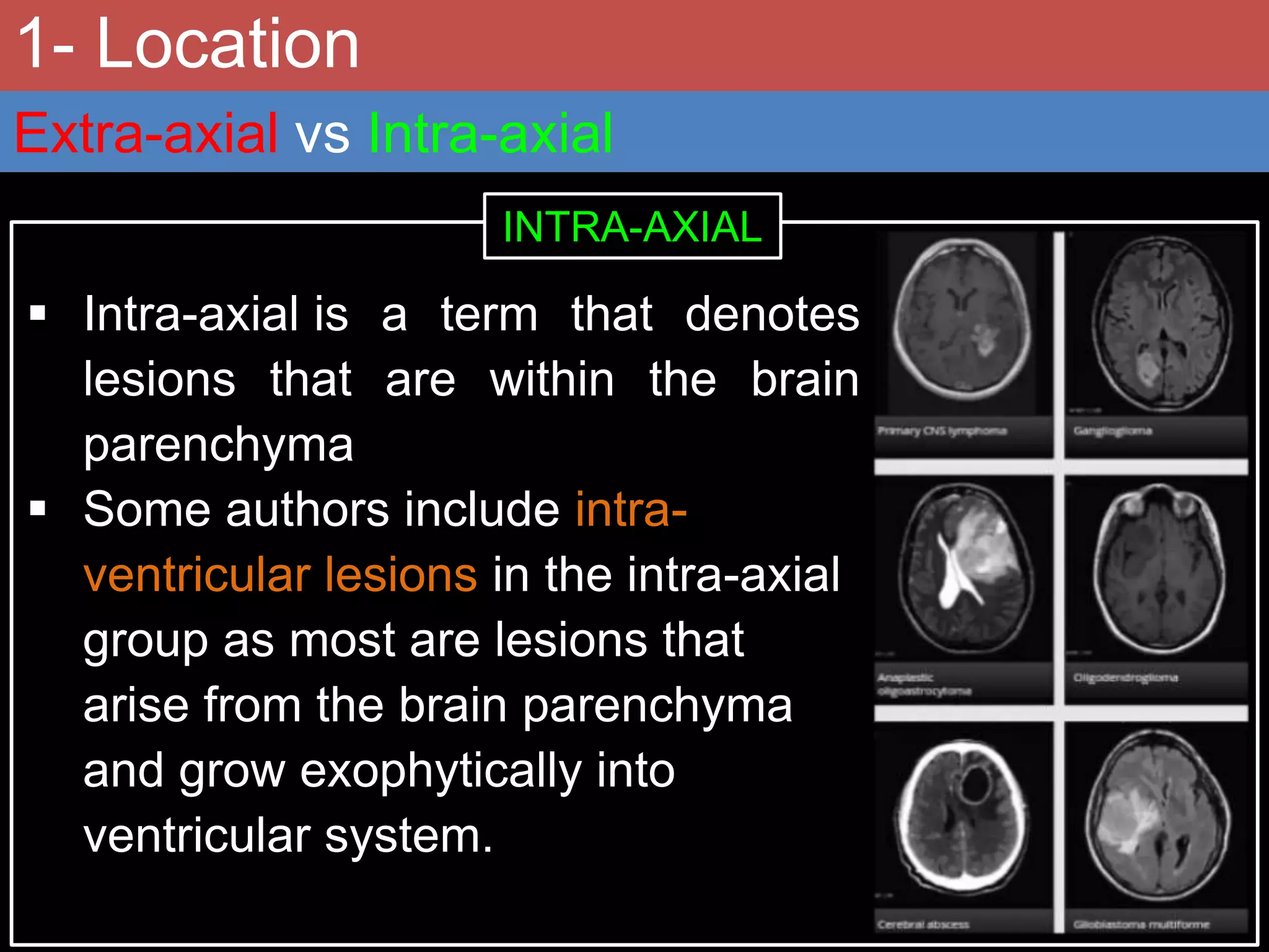 Normal & abnormal radiology of brain part iv | PPTX