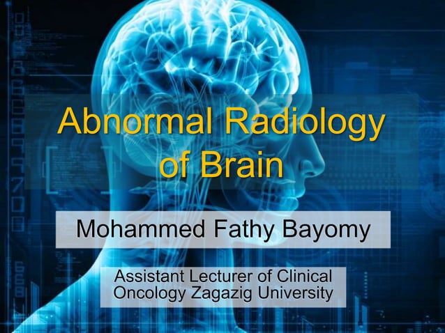 Normal & abnormal radiology of brain part iv | PPTX | Brain and Nervous ...